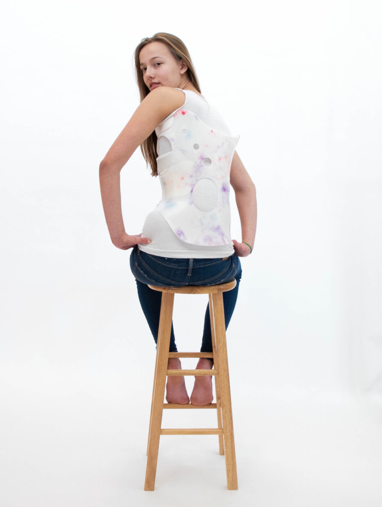 Rigo Cheneau TLSO: Rising Above the Status Quo | National Scoliosis Center