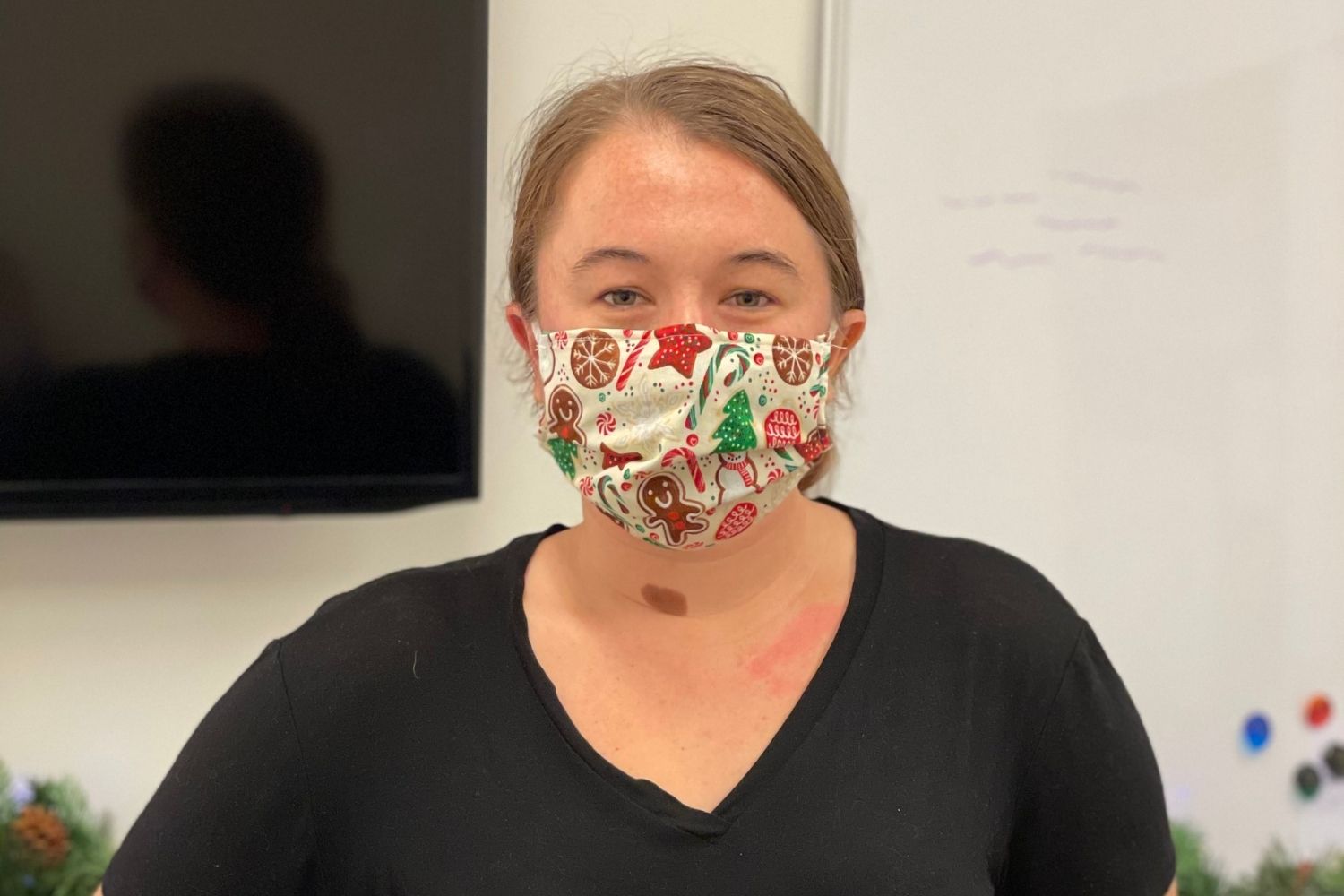 One of the First Patients to Wear a Rigo Cheneau Brace in the United ...