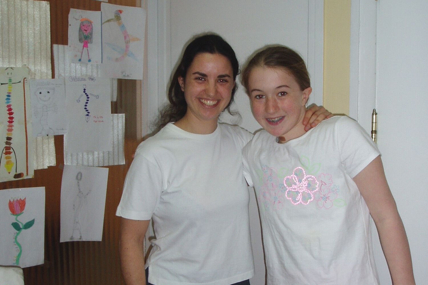 One of the First Patients to Wear a Rigo Cheneau Brace in the United ...